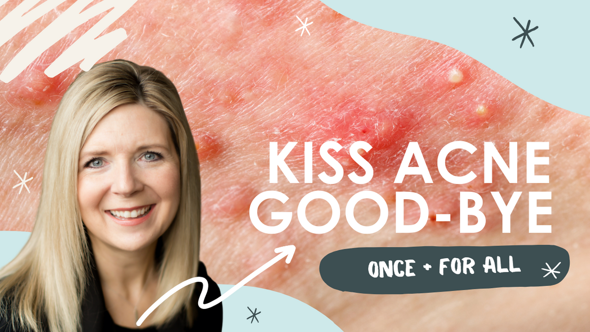 Kiss Your Acne Good-Bye Once + For All – Estetica Spa